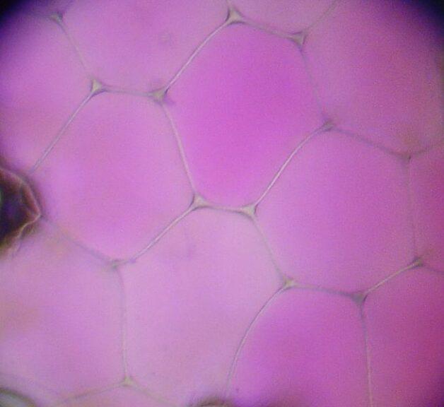plasmolysis gcse
