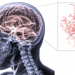 Neuron - Definition and Examples - Biology Online Dictionary