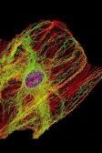 Fibroblast - Definition and Examples - Biology Online Dictionary