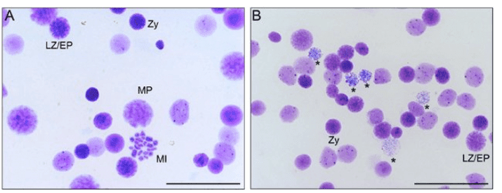 Prophase - Definition and Examples - Biology Online Dictionary