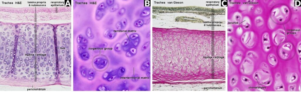 Hyaline Cartilage Trachea Labeled