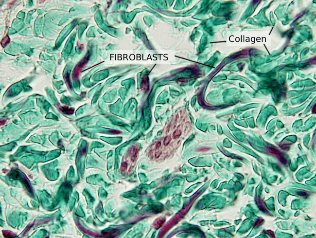 Fibroblast - Definition and Examples - Biology Online Dictionary
