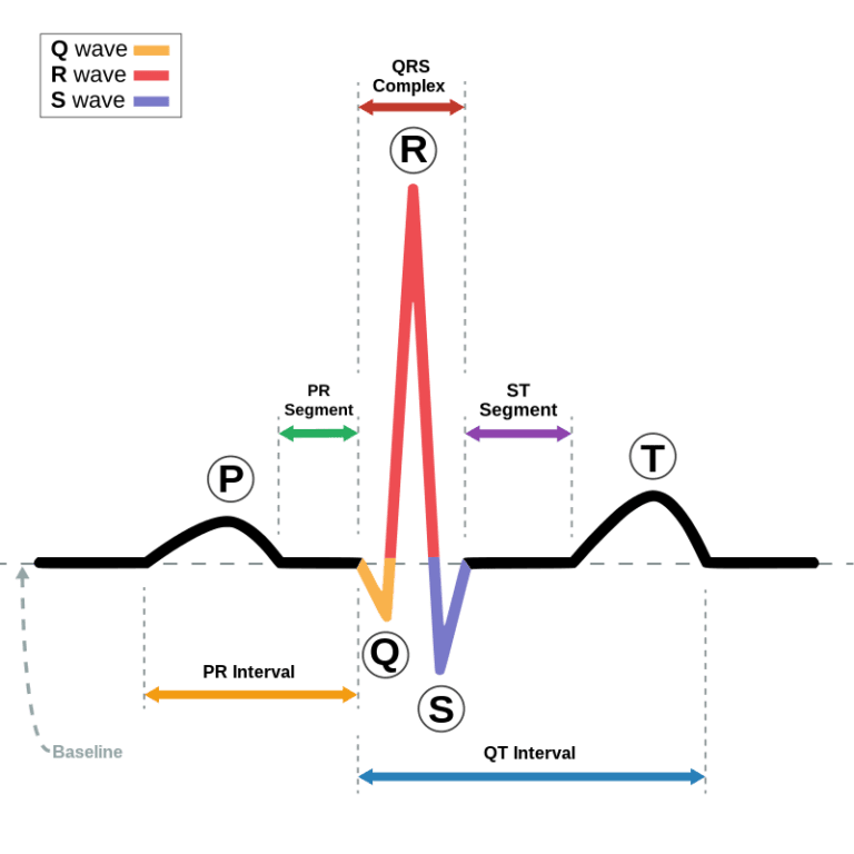 Agonal rhythm - Definition and Examples - Biology Online Dictionary