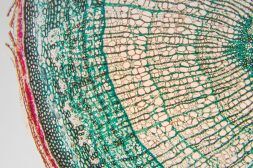 Pit Definition and Examples - Biology Online Dictionary