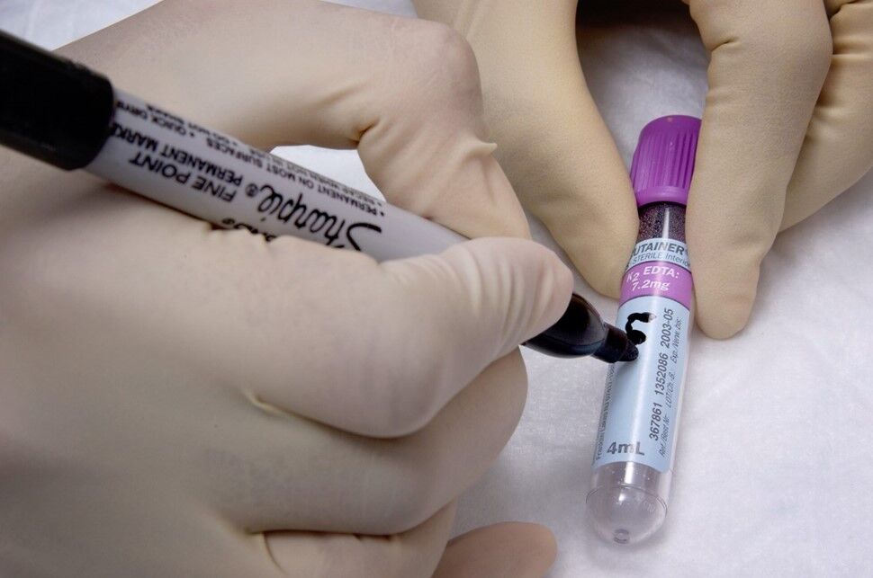 Specimen - Definition and Examples - Biology Online Dictionary